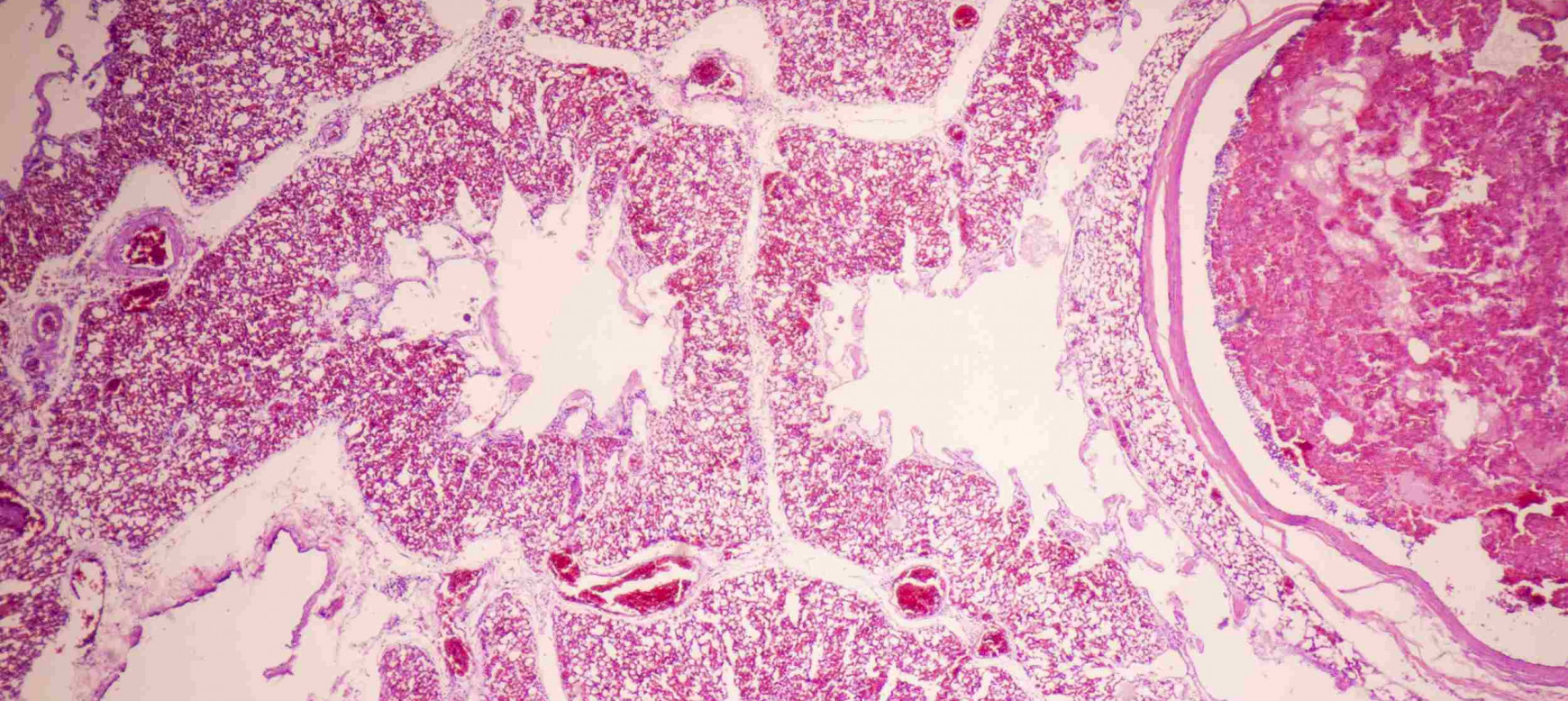 Viable immune cells from murine lungs: isolation and identification ...
